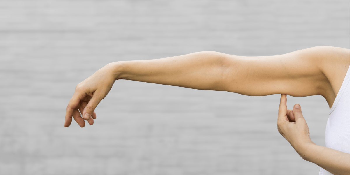 What Is Sarcopenia? – Bariatric Fusion